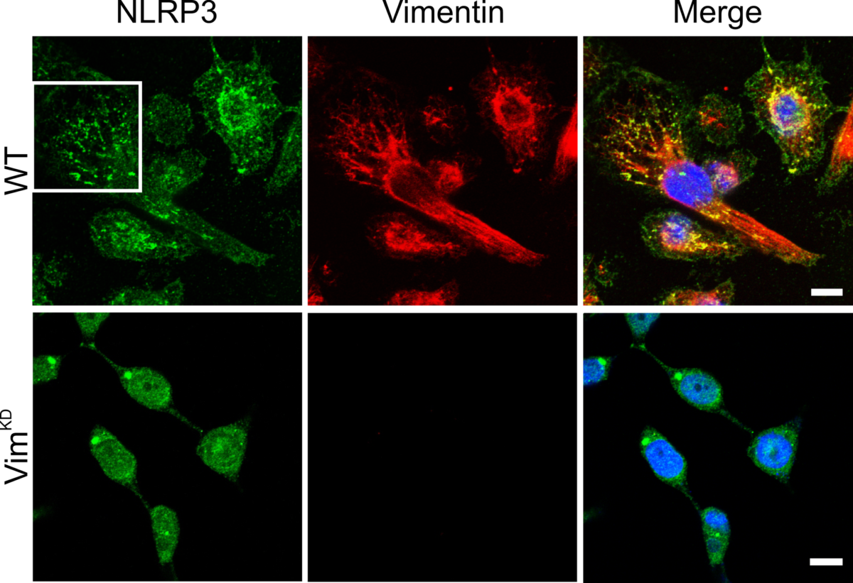 Vimentin Implicated in Lung Inflammation and Fibrosis - News Center