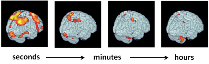 Mapping the Stages of Motor Memory - News Center