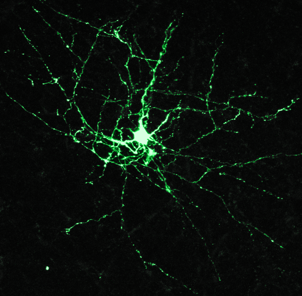 Delayed Development of Fast-Spiking Neurons Linked to Fragile X - News ...