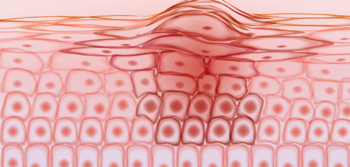 Skin Deep: The Skin Biology and Diseases Resource-Based Center - News ...