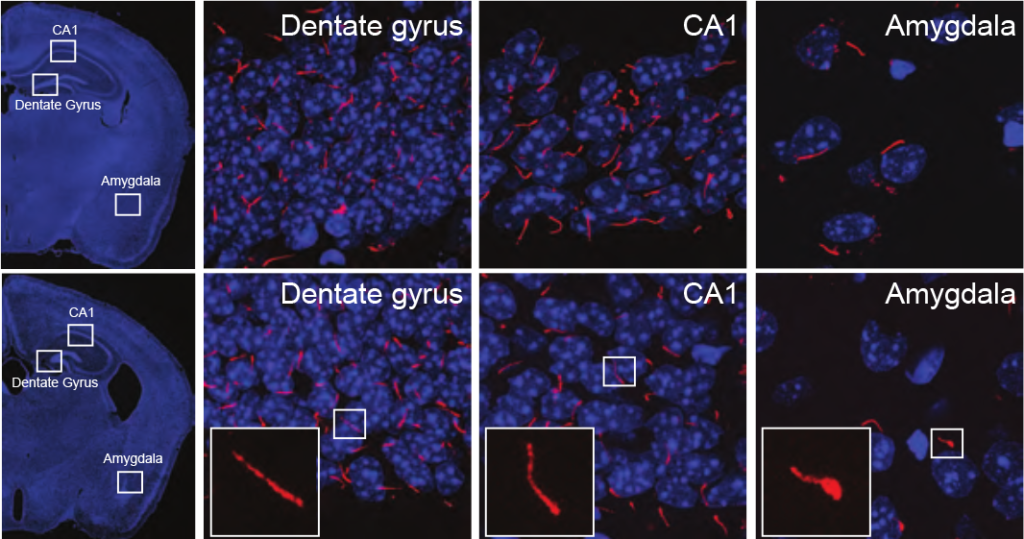 Cilia Defects Linked to Schizophrenia - News Center