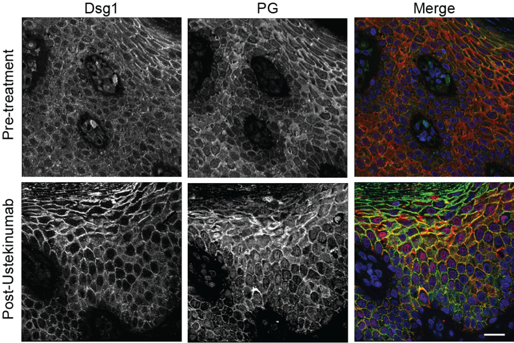 Uncovering Cellular Mechanisms of Genetic Skin Diseases - News Center