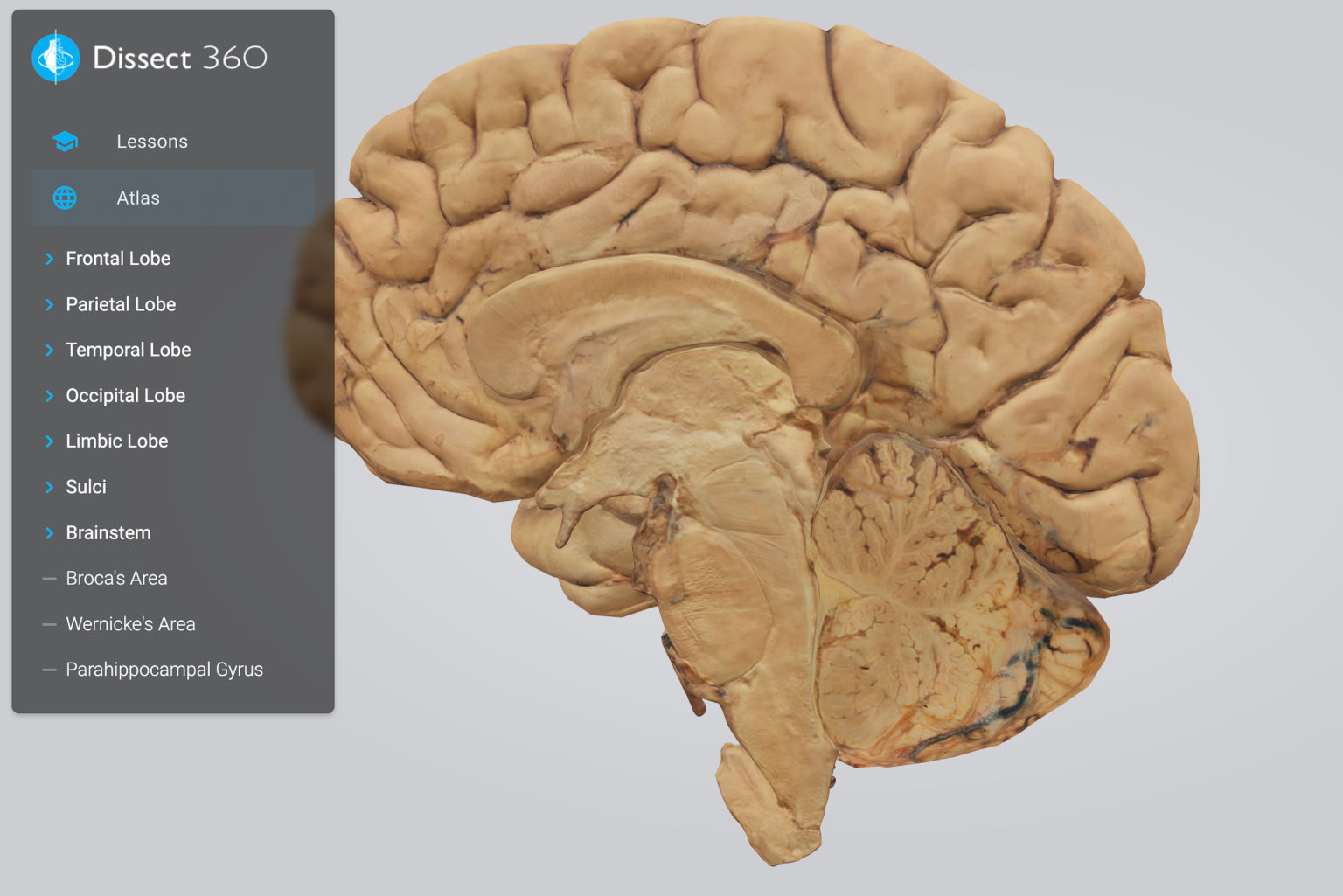 3D Anatomy Learning Tool Wins National Science Foundation Prize - News ...